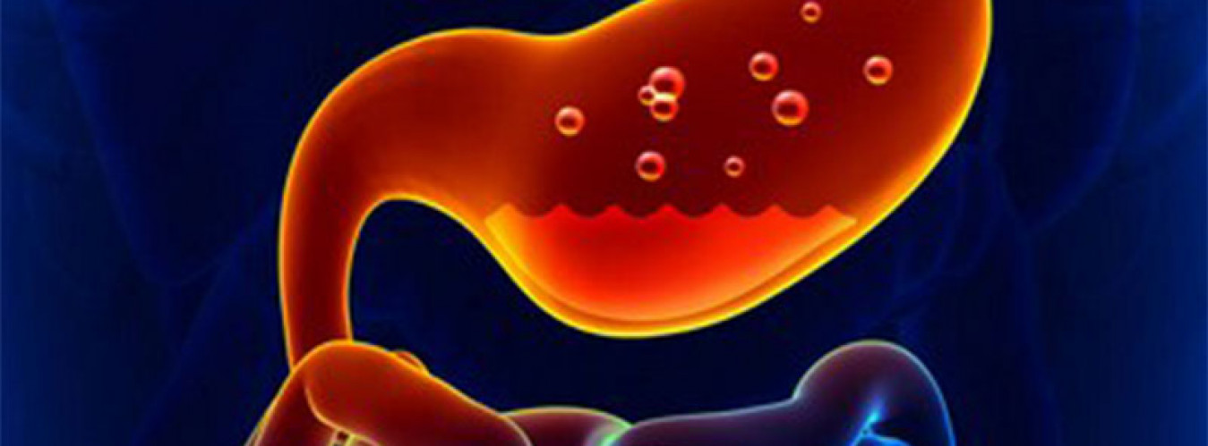 Functional Dyspepsia: A Rome IV MDCP Perspective | CME Learning Center ...