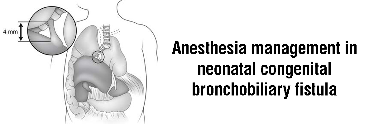 Anesthesia management in neonatal congenital bronchobiliary fistula