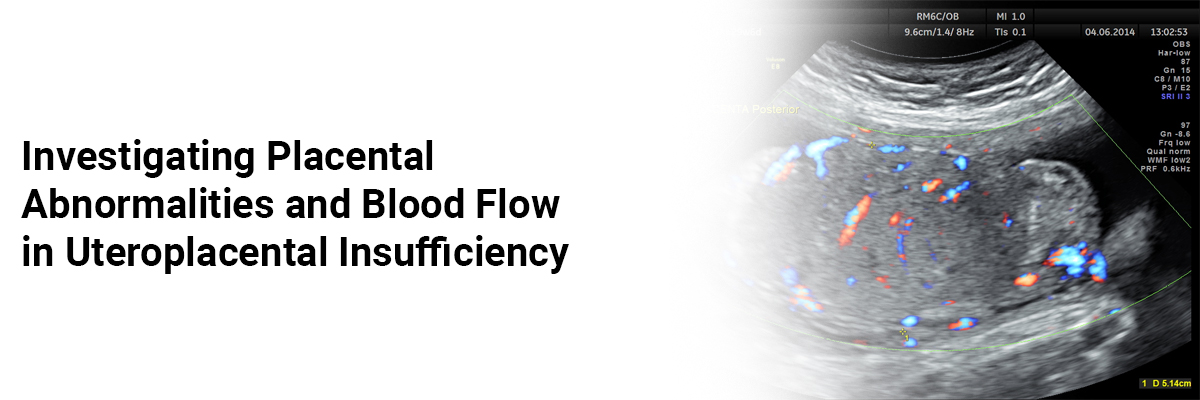 Investigating Placental Abnormalities and Blood Flow in Uteroplacental ...
