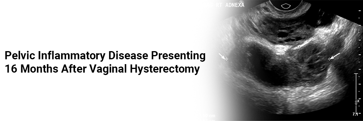 Pelvic Inflammatory Disease Presenting 16 Months After Vaginal Hysterectomy