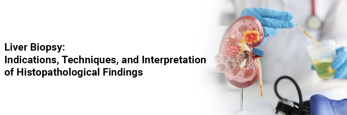 Liver Biopsy Procedure Indications Needle Names Site