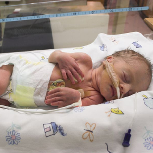 Proactive perinatal care benefits periviable preterm infants