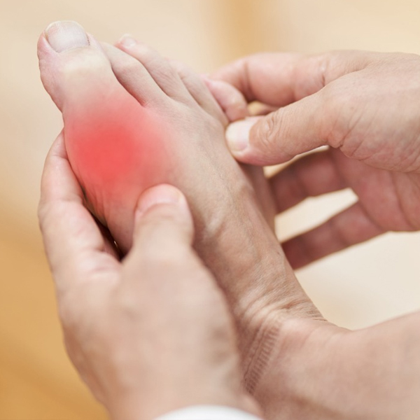 Benefits of bariatric surgery in hyperuricemia management