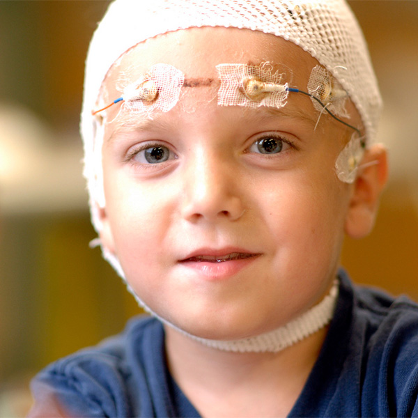 Benefits of Psychiatric Interventions in Children with Epilepsy