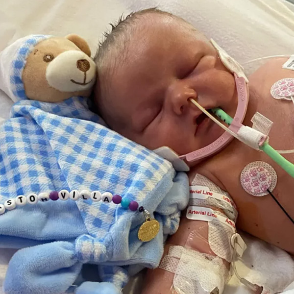 A case report of Functional analysis of a missense variant in INSR ...