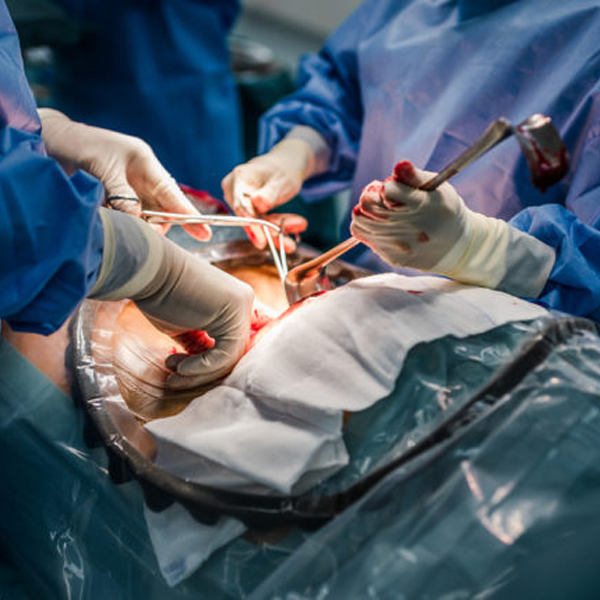 Surgical Approach to Mitigate the Risks of Complications in Cesarean ...