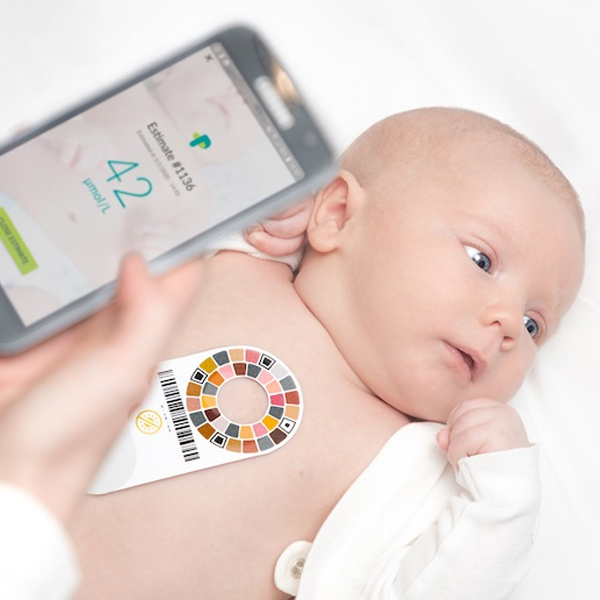 A Smartphone application to quantify jaundice in neonates