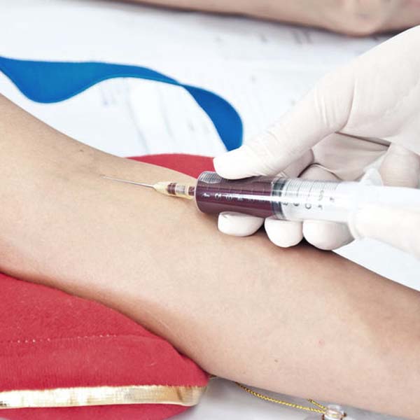 Allergy Blood Test: Purpose, Procedure & Benefits