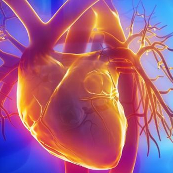 Characteristics of angina?