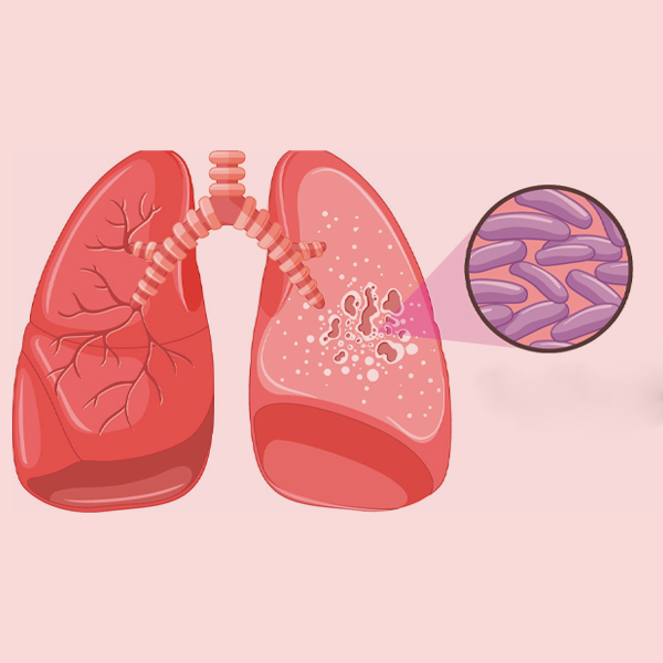 DILI From Antitubercular Treatment