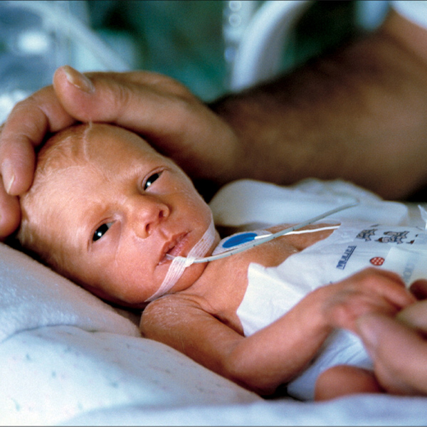 Deaths in a Modern Cohort of Extremely Preterm Infants from the Preterm ...