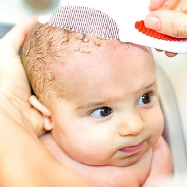 Diagnosis and Management of Seborrheic Dermatitis