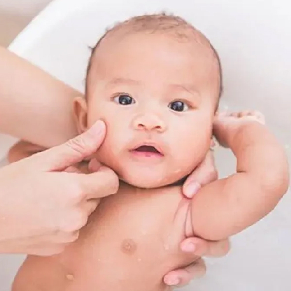 Frequent Versus Infrequent Bathing in Pediatric Atopic Dermatitis