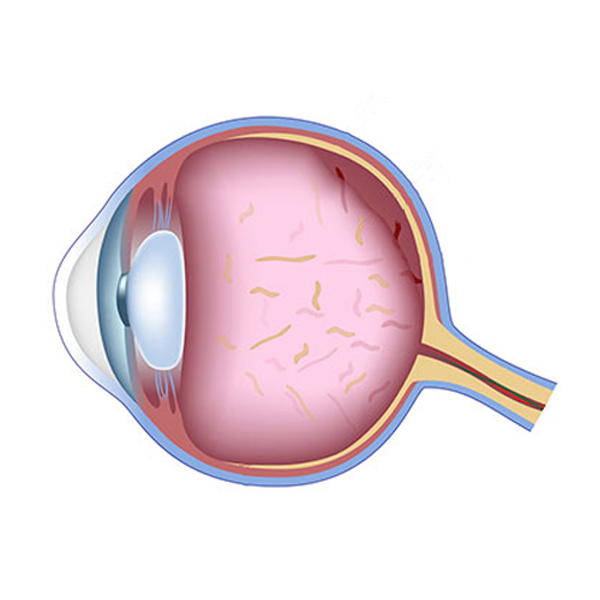 How is the retina examined? | Dr. Manisha Agarwal