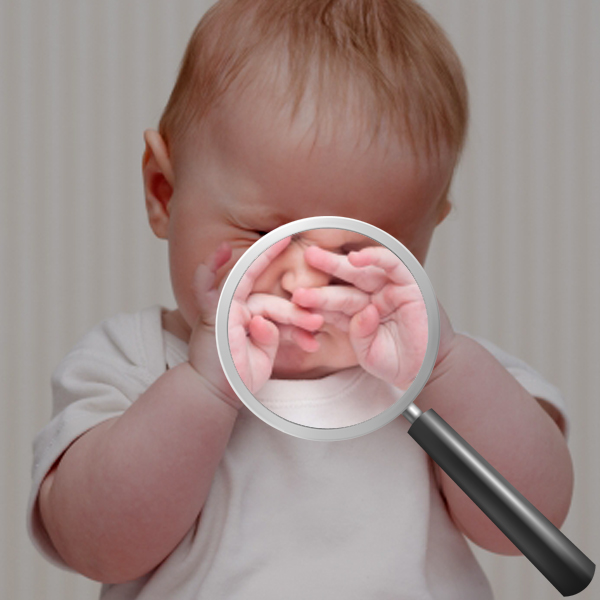 How to know if your baby has allergies|Medtalks