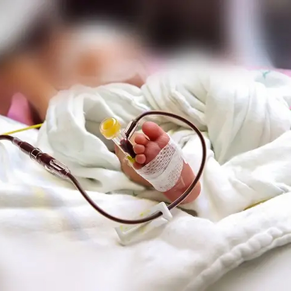 Reducing Blood Sampling in Premature Neonates | Lower Transfusion Needs ...