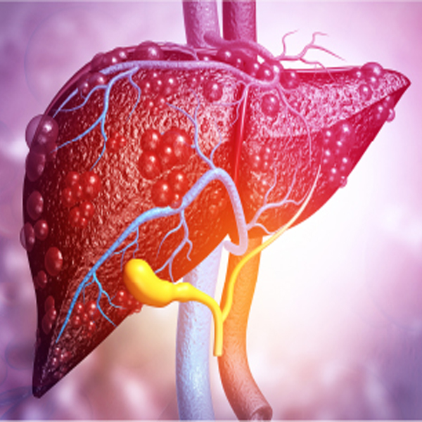 Managing NAFLD in Obese Individuals