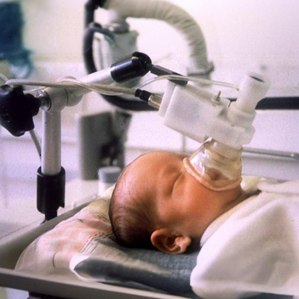 Pulmonary Function Tests in Infants with Airway Anomalies and ...