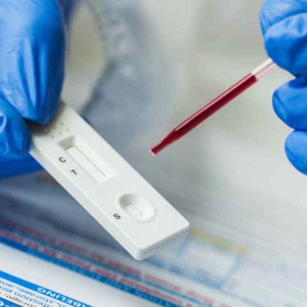 Rapid Antibody Detection Test for Scrub Typhus