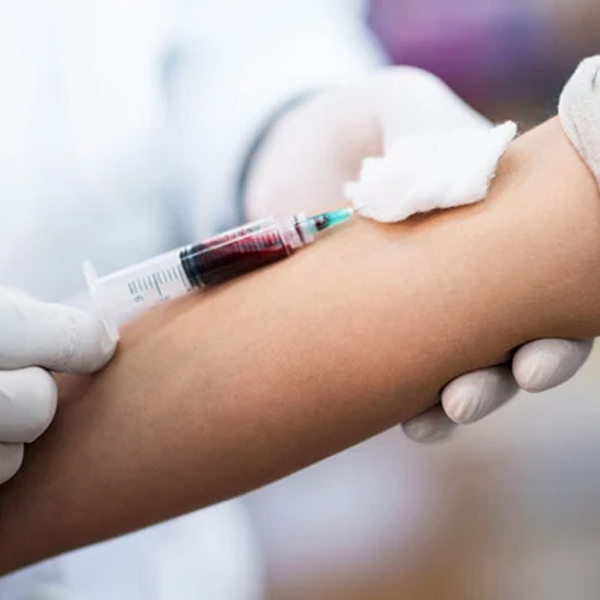 Serum Calcium Blood Tests: Clinical Relevance and Interpretation