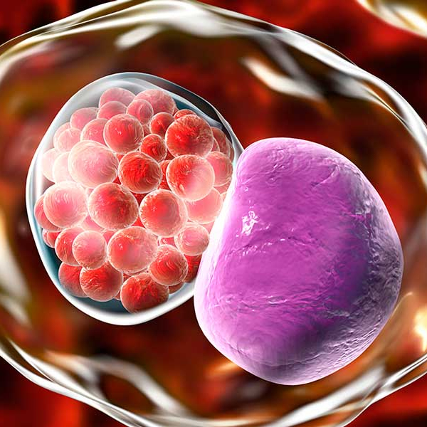 The Correlation between Chlamydia Trachomatis and Female Infertility: A ...