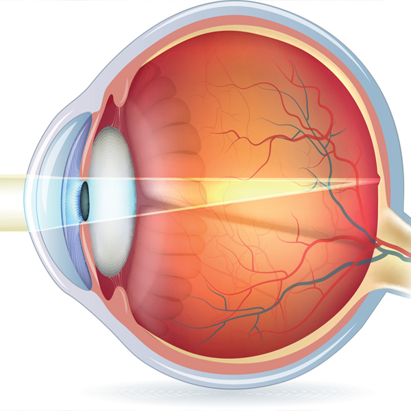 What is Refractive Error and what are its causes? | Dr. Suma Ganesh