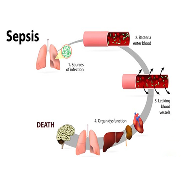 What is sepsis clock?