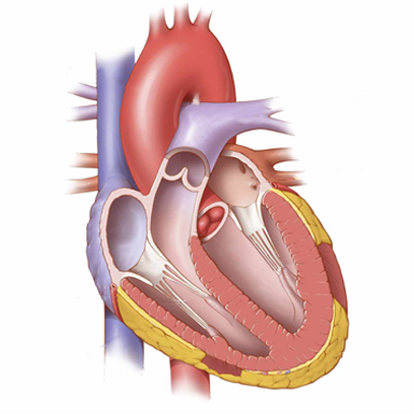 Acute Heart Failure: Types, Causes, and Symptoms | Medtalks
