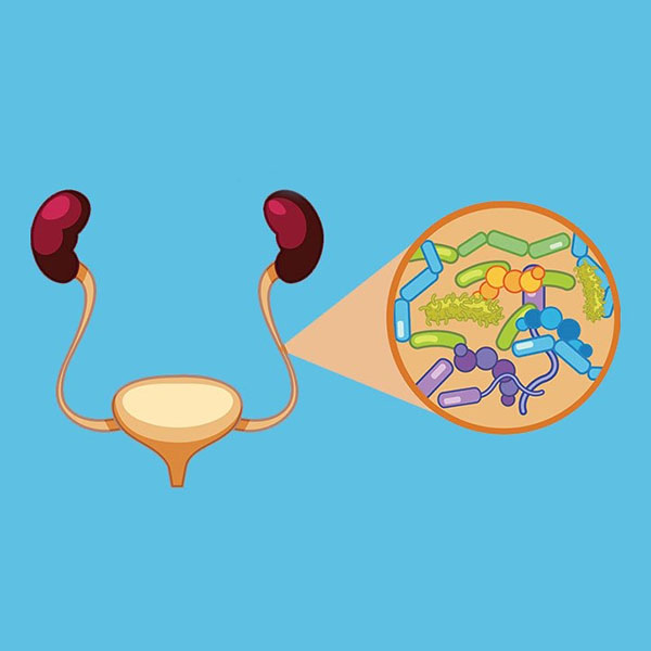 What are the Main Causes of UTI?