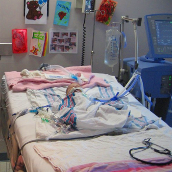 When should we operate a TGA baby? | Dr. Smita Mishra