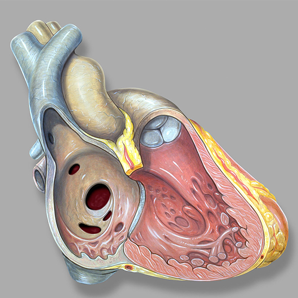 Atrial Septal Defect Asd Symptoms And Causes Medtalks