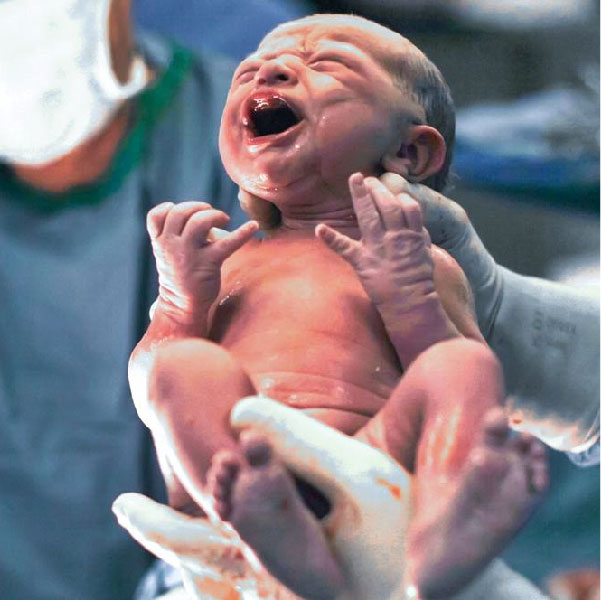 Doctors Demonstrate Breakthrough Fetal Surgery as a Definitive ...