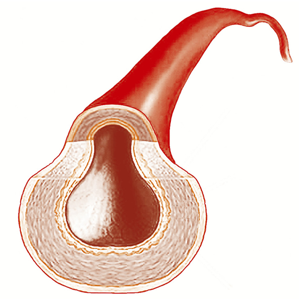 How to check for Endothelial functions? | Dr. R.R Kasliwal