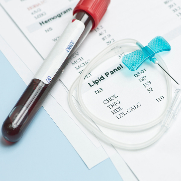 LDL Cholesterol Blood Test | Level | Dr. Sunil Dargar | MedTalks