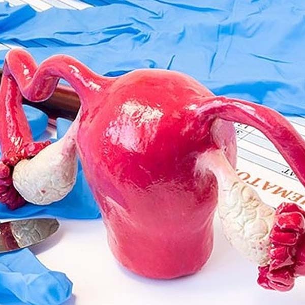 हिस्टेरेक्टॉमी क्यों की जाती है | Why is a Hysterectomy Performed ...