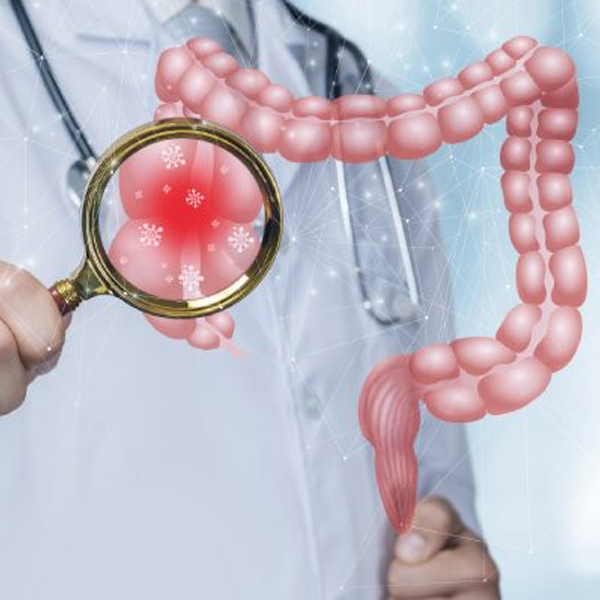 म्यूकस फिस्टुला क्या है? | Mucus Fistula in Hindi