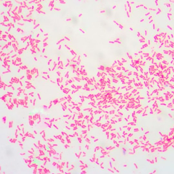 What are the common gram-negative organisms showing AMR? | Dr. Sunil Gupta