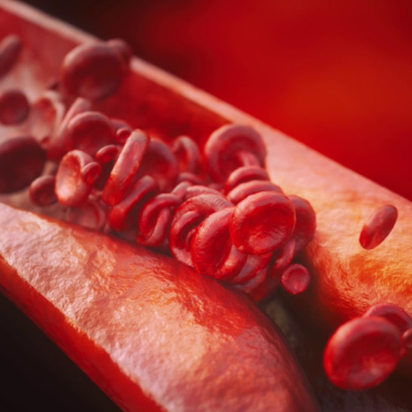 What is the role of Ticlopidine in Acute MI? | FAQ answered by Dr ...