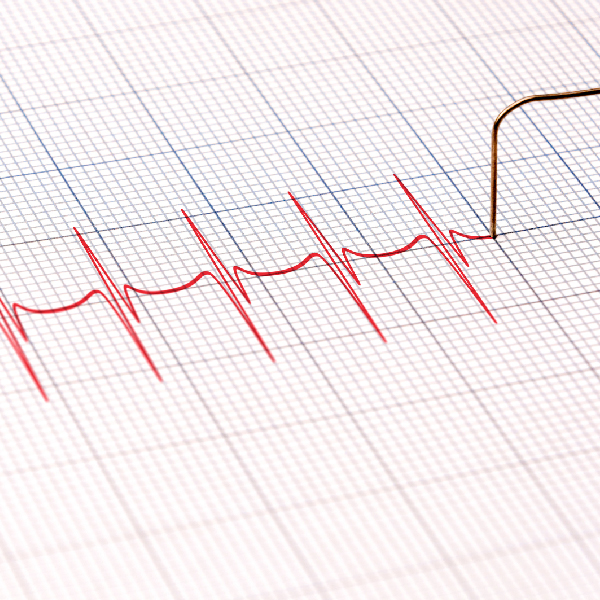 एक्टोपिक दिल की धड़कन क्या है? कारण, लक्षण और इलाज | What is Ectopic ...